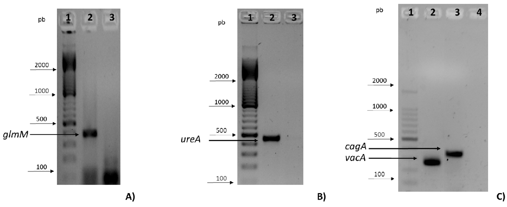 Identification of Helicobacter pylori by polymerase chain reaction in ...